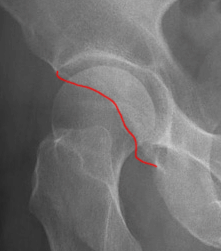 Becken / Hüfte Arzt | OrthoRad